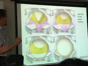 Levator Avulsion: Simply Explained | Pelvic Floor Recovery