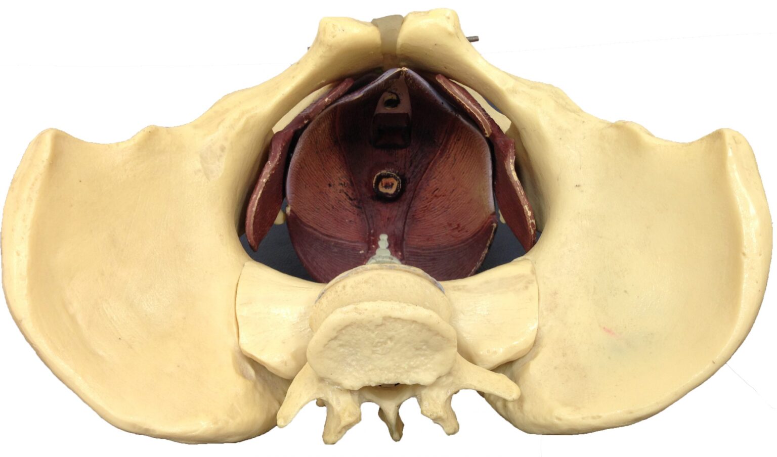 Levator Avulsion: Simply Explained | Pelvic Floor Recovery