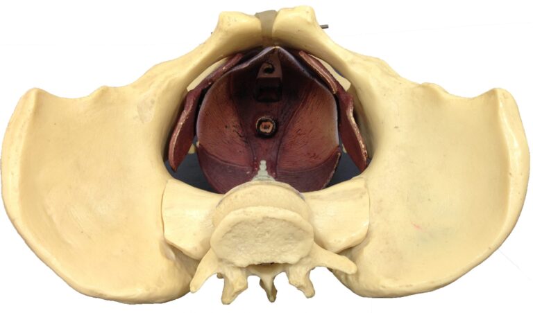 Levator Avulsion: Simply Explained | Pelvic Floor Recovery
