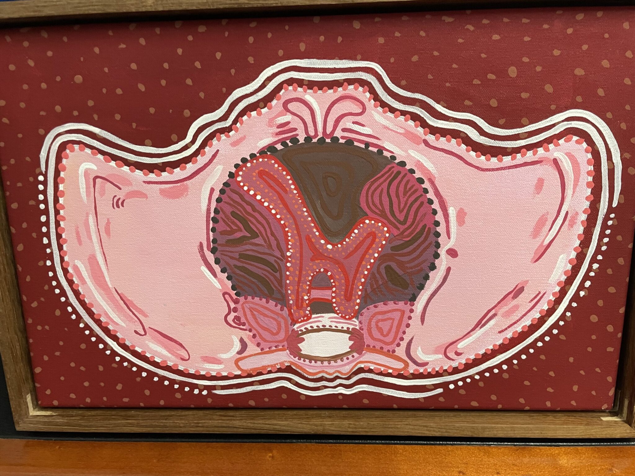 Levator Avulsion: Simply Explained | Pelvic Floor Recovery